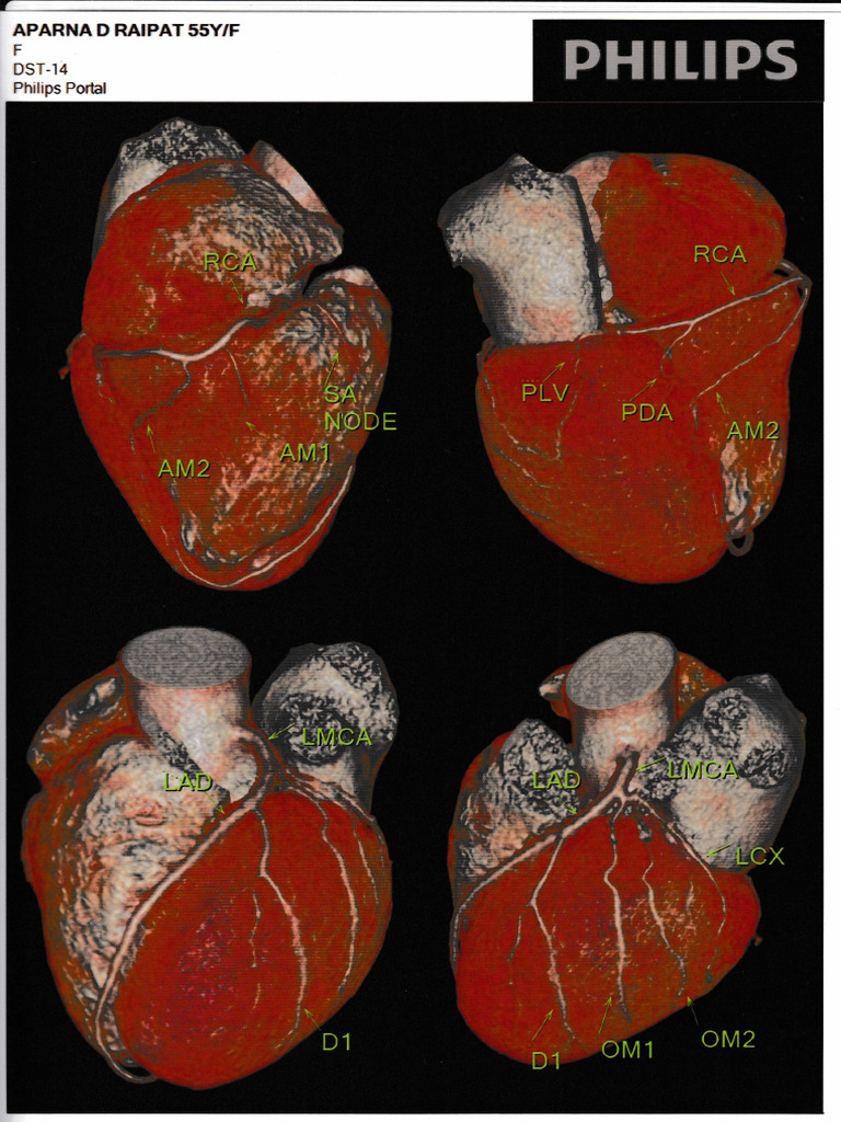 CT Angio Scan - 20240904 - 0001 | PDF
