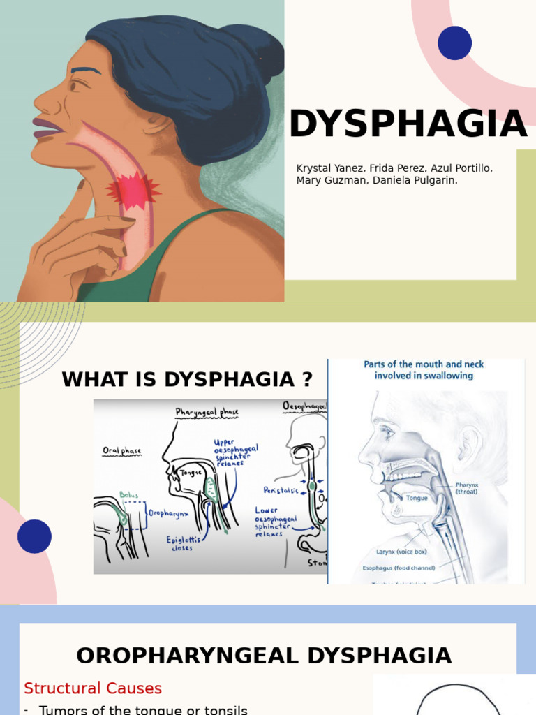 Dysphagia Powerpoint | PDF