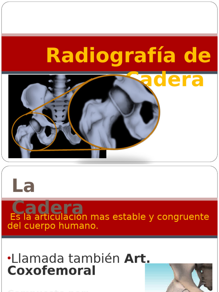 Radiografia Cadera | PDF