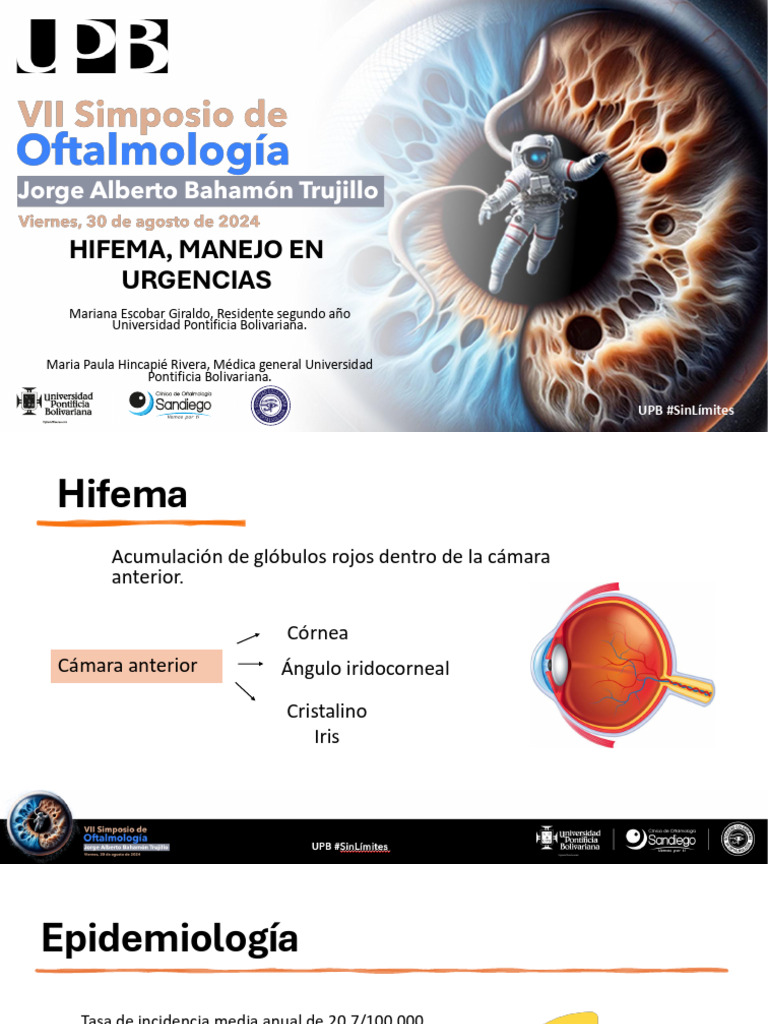 Hifema, Manejo en Urgencias | PDF