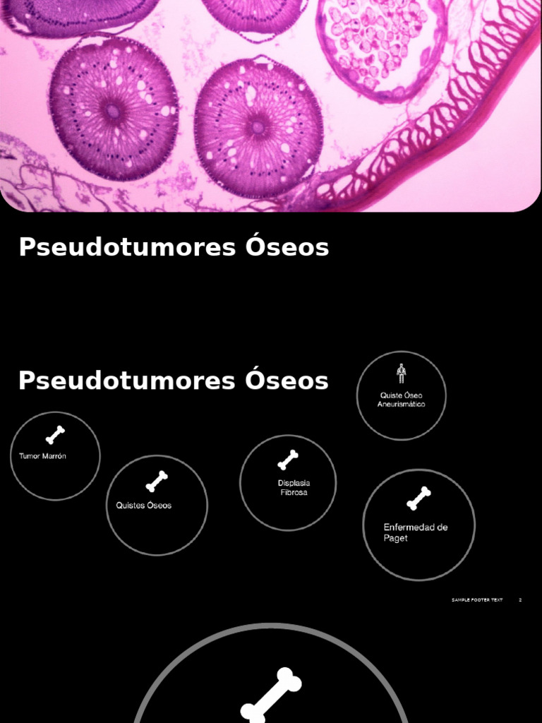 Pseudo Tumor Es | PDF