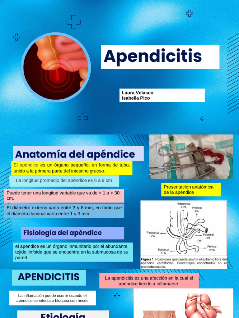 Apendicitis Pptx2 | PDF