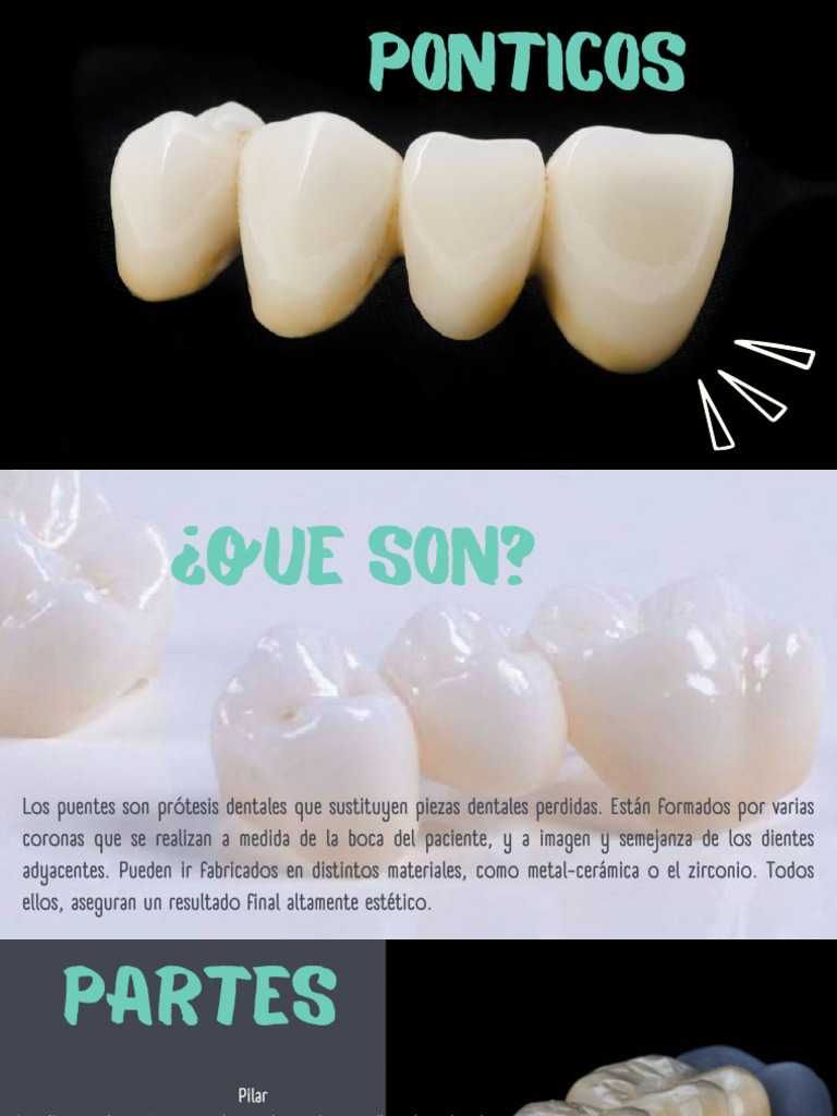 PÓNTICOS | PDF