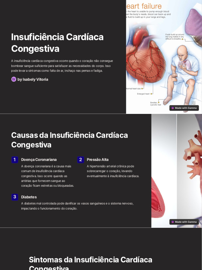 Insuficiência Cardíaca Congestiva: by Isabely Vitoria | PDF