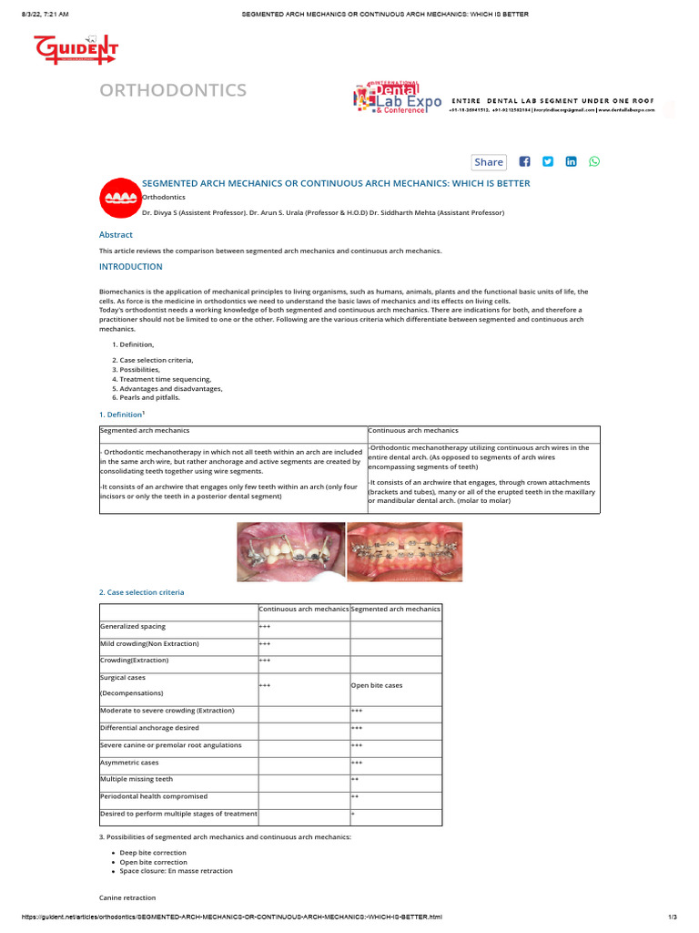 Segmented Arch Mechanics or Continuous Arch Mechanics - Which Is Better ...