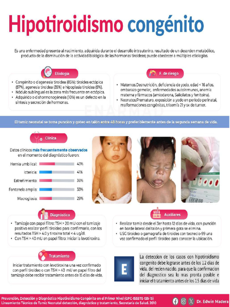 Hipotiroidismo Congenito | PDF