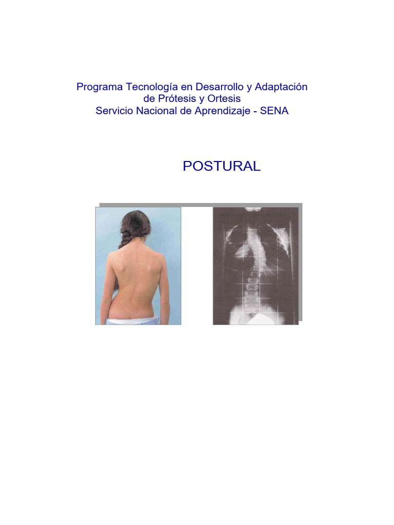 Guia Evaluación Postural | PDF