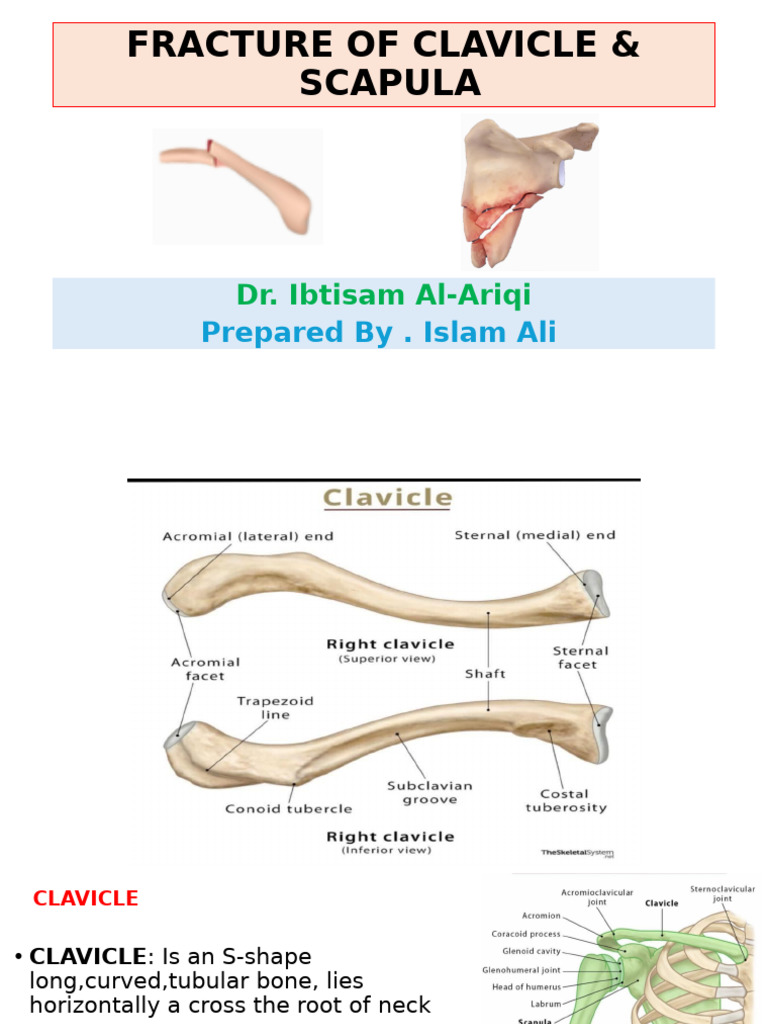 Clavicle Fracture Classification Overview | PDF | Shoulder | Limbs ...