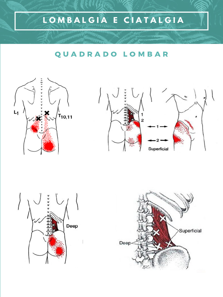 Dry40 Mapa Dor Referida | PDF