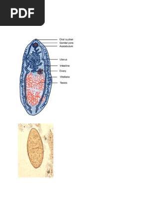 Fasciolopsis Buski Morphology