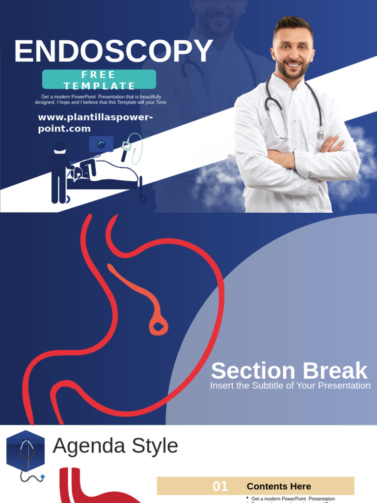 Plantilla Powerpoint de Endos | PDF