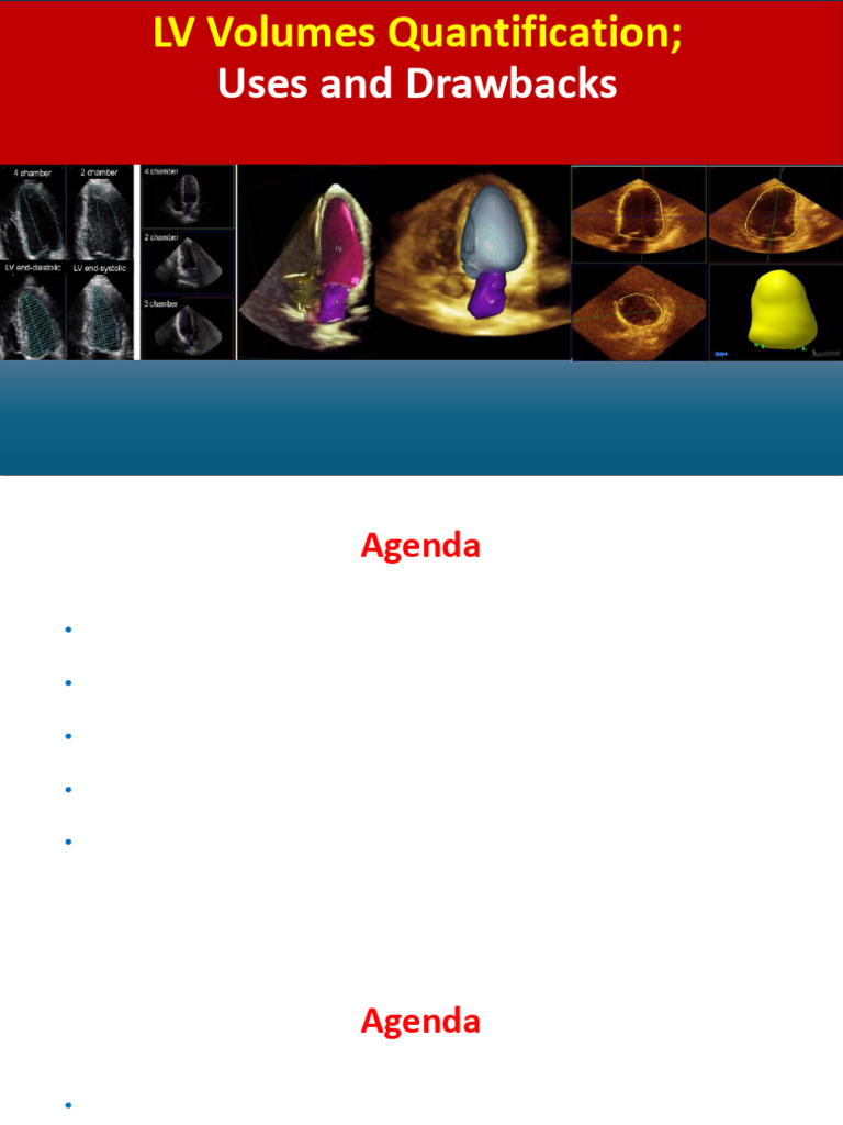 Quantification of LV Volumes | PDF | Echocardiography | Ventricle (Heart)