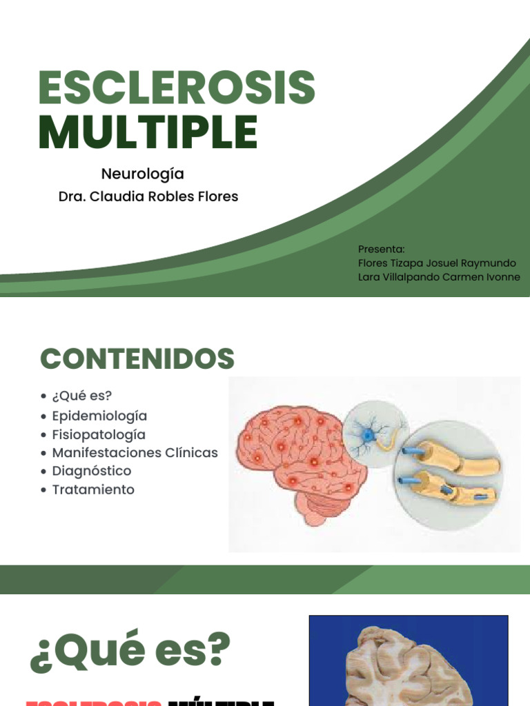Esclerosis Múltiple | PDF