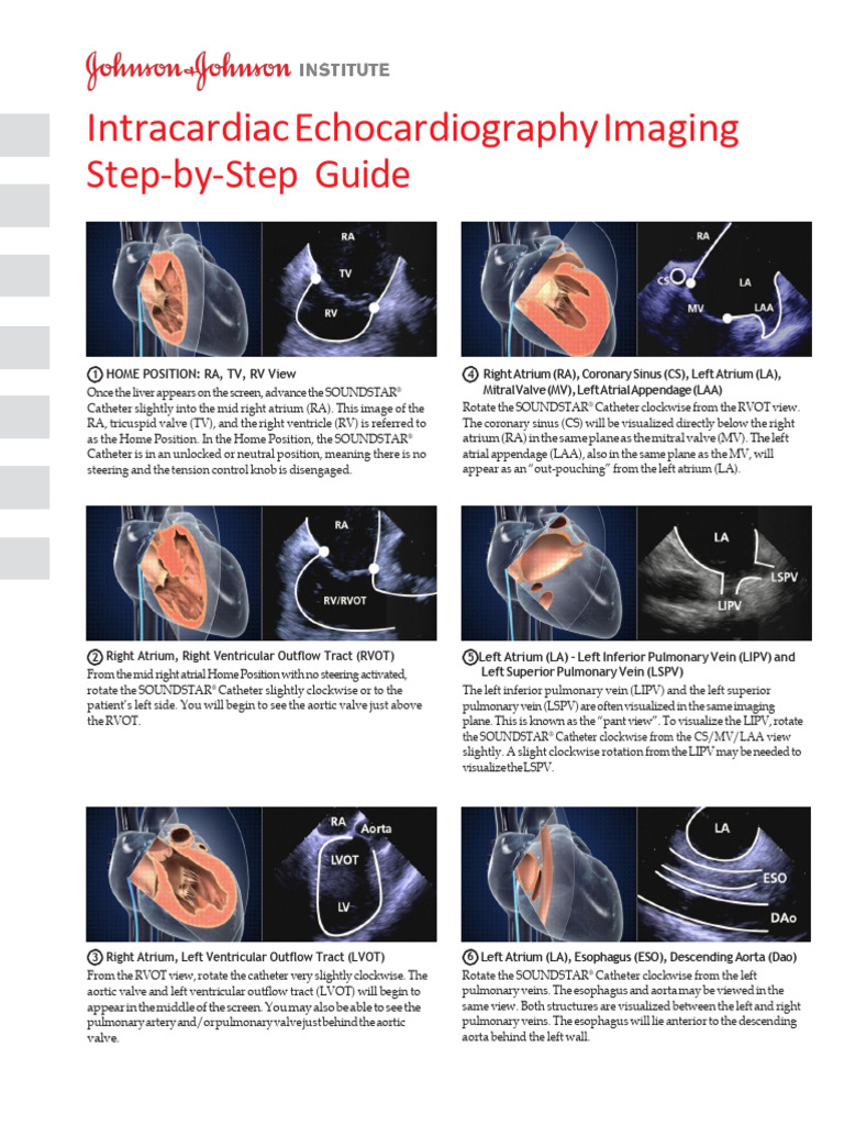 Catheter Manipulation Step by Step Guide | PDF