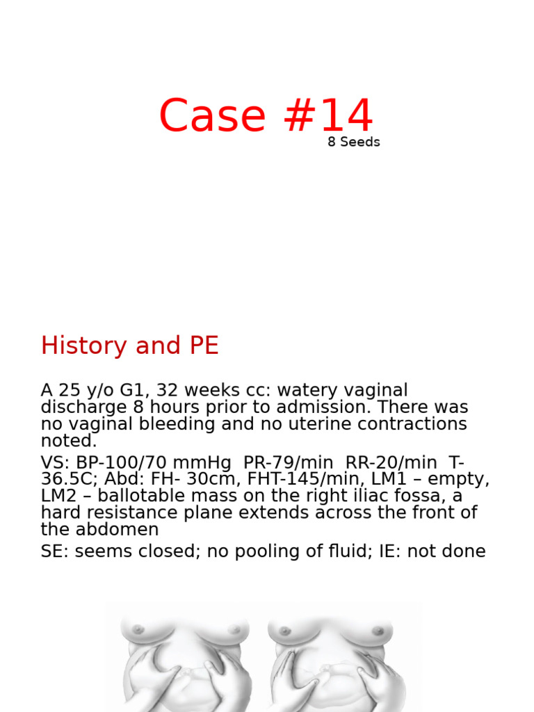 Case 14 2 | PDF