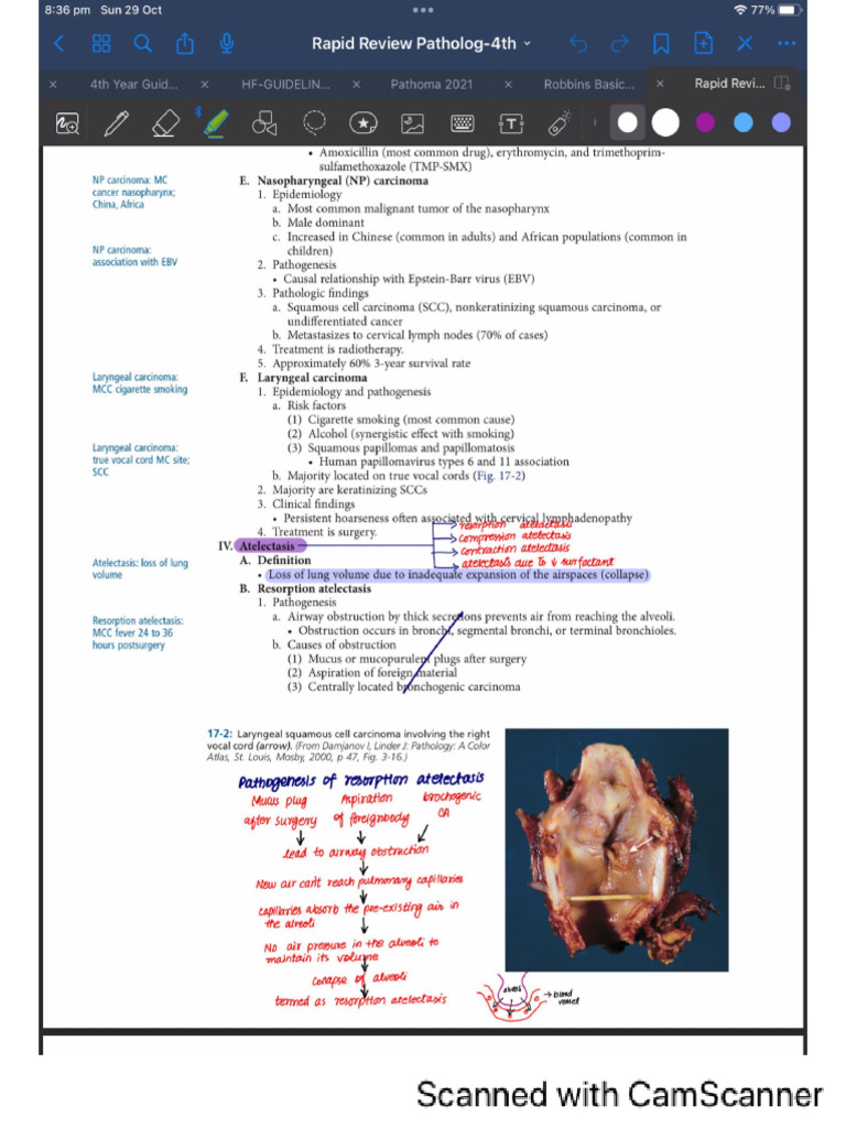 Respo Pathology | PDF