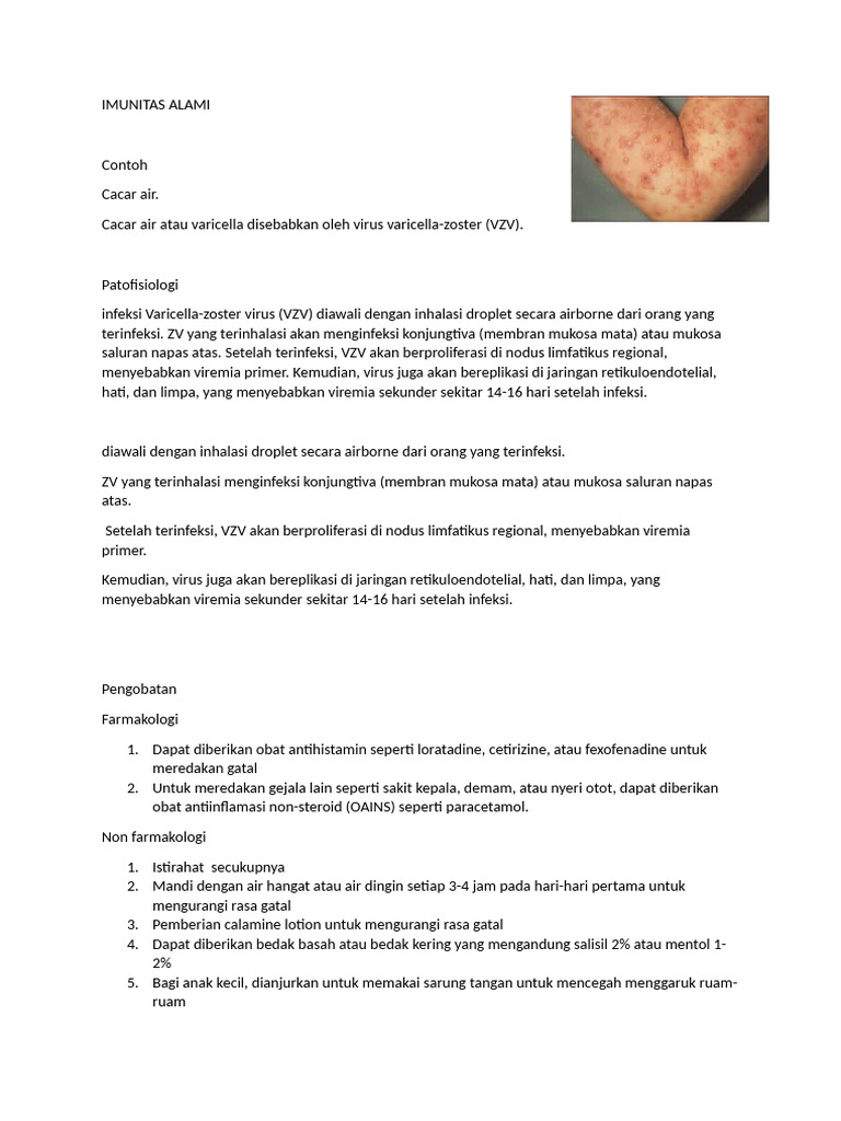 Imunitas Alami Contoh | PDF