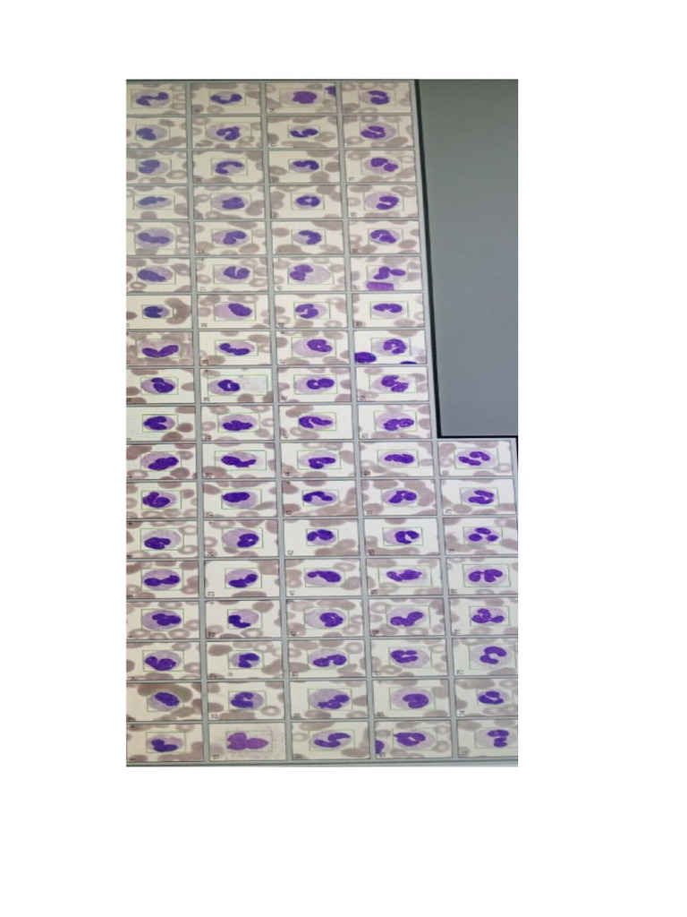 Segmented Neutrophils | PDF