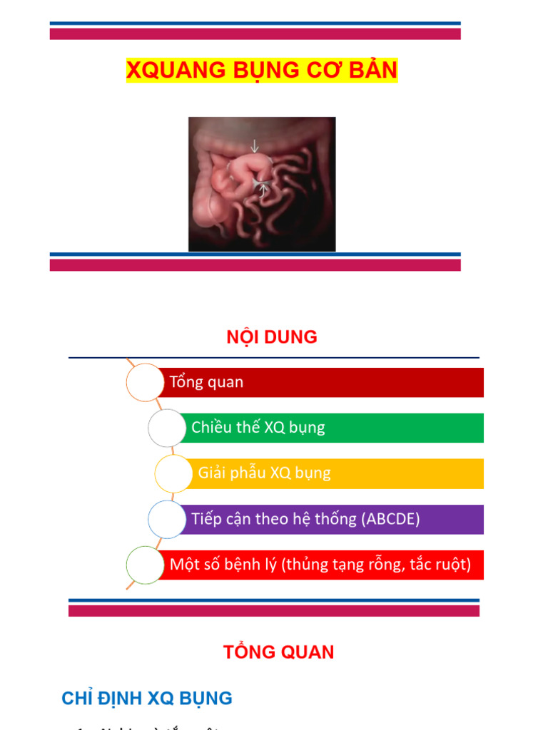 Bài 60-Xquang-B Ng-Cơ-B N | PDF