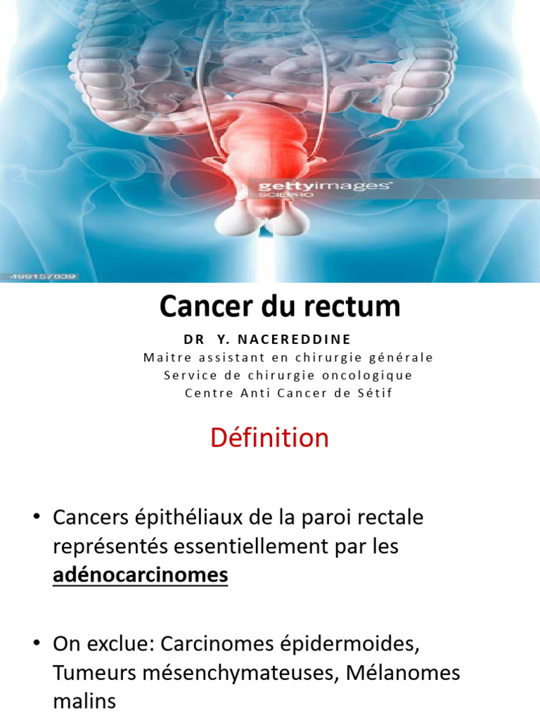 7-Cancer Du Rectum | PDF
