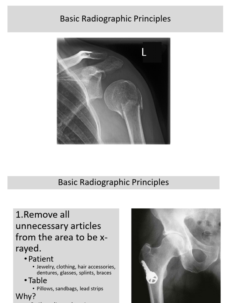 Basic Radiographic Principles | PDF