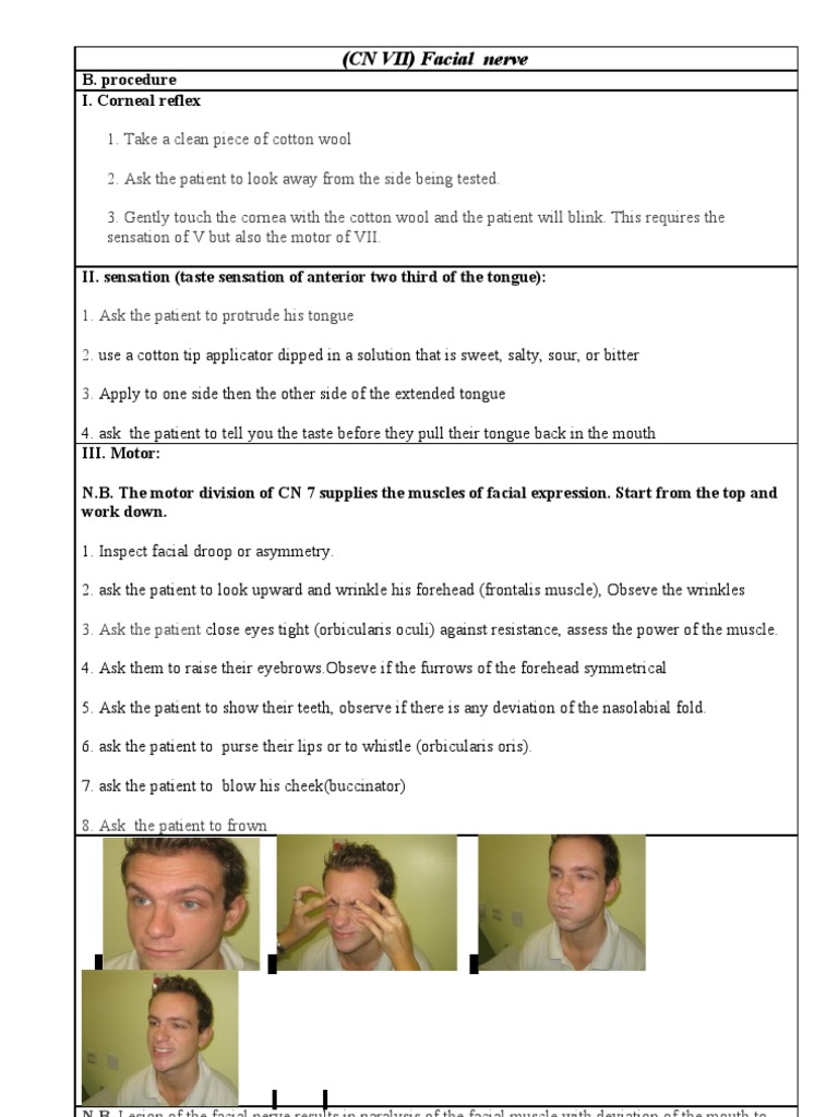 Facial Nerve Exam Procedures | PDF | Wellness