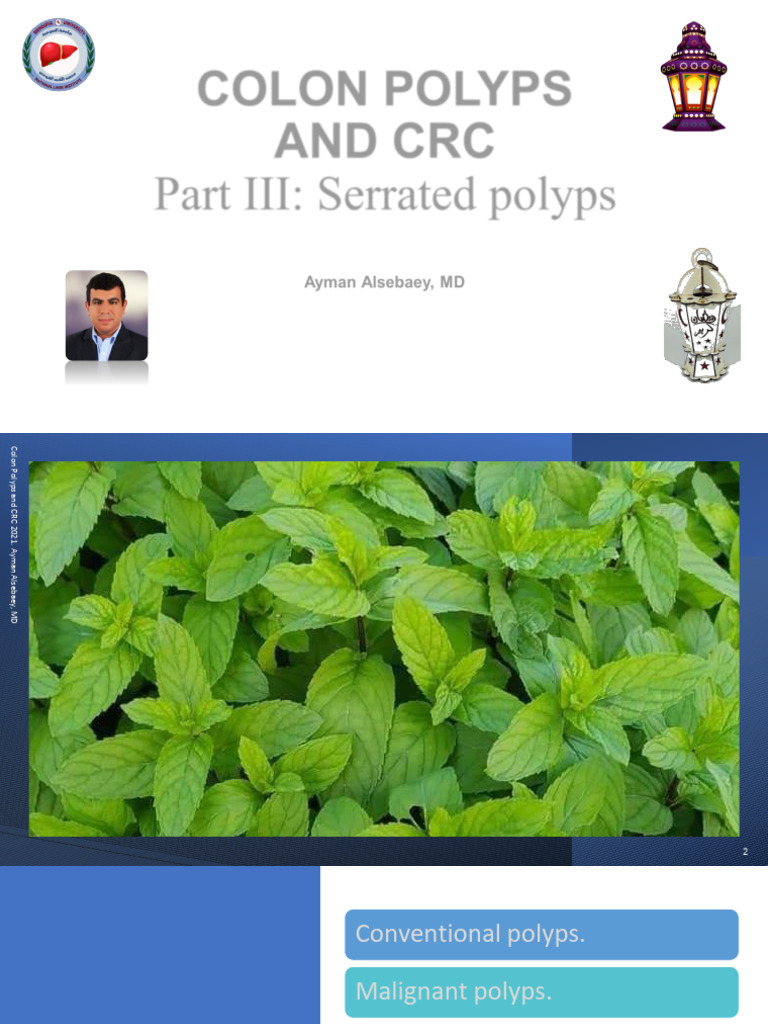 Colon Polyps and CRC Part III Serrated Polyp 2021 | PDF | Colorectal Cancer | Science & Mathematics