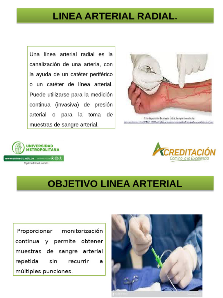 Linea Arterial 1 | PDF