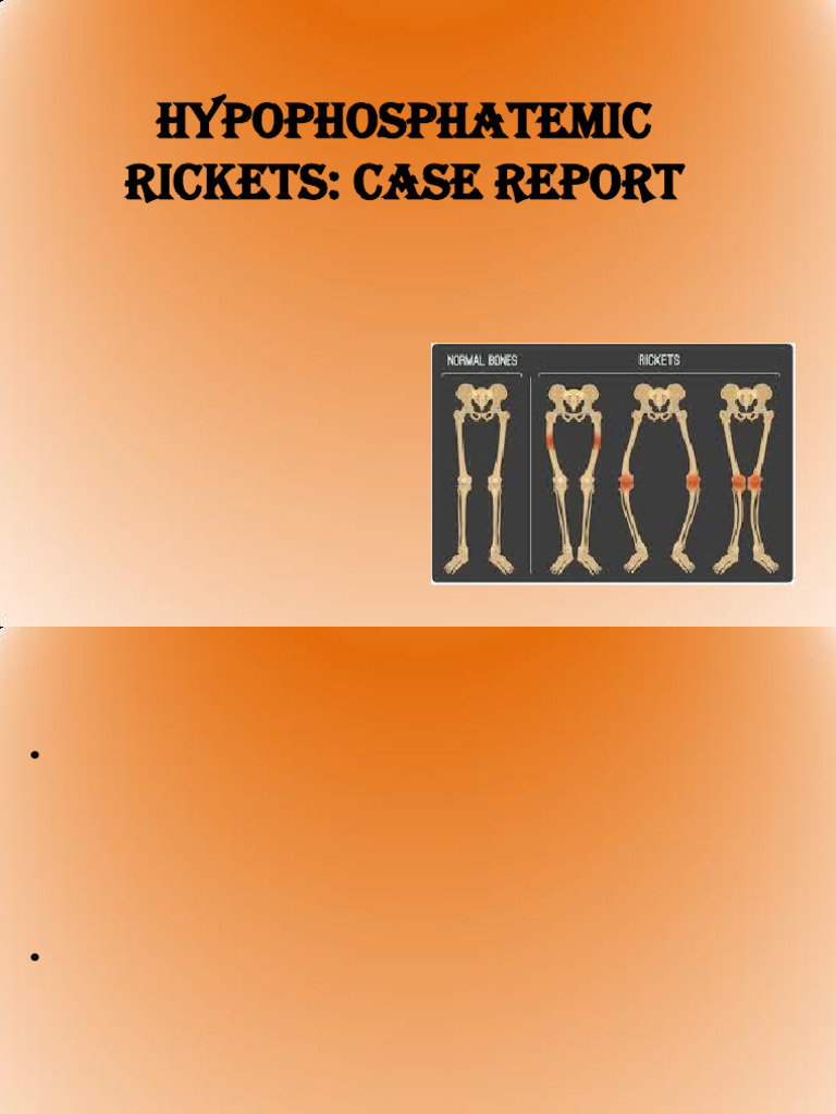 Hypophosphatemic Rickets | PDF