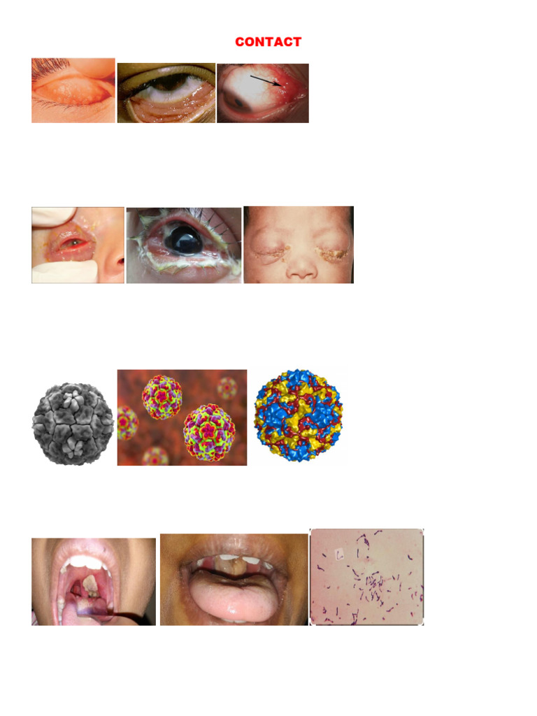 MicroBio Notes | PDF