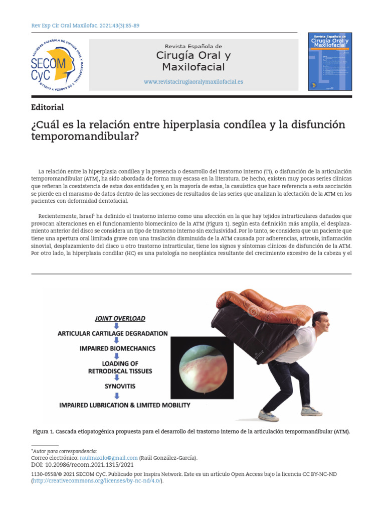 Relación Entre Hiperplasia Condílea y La Disfunción Temporomandibular | PDF