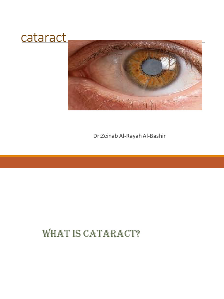 5 - Cataract | PDF
