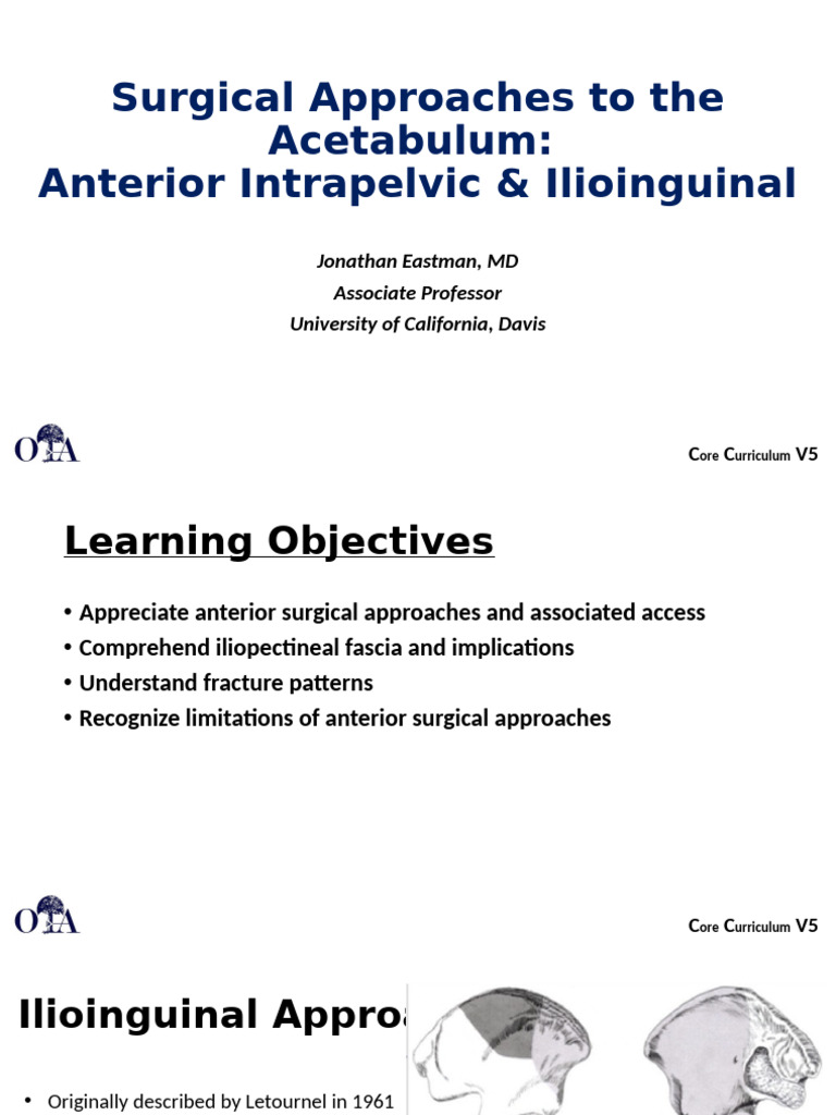 Surgical Approaches To The Acetabulum: Anterior Intrapelvic ...