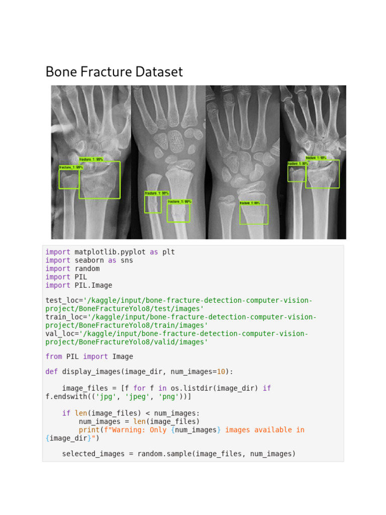 Bone | PDF