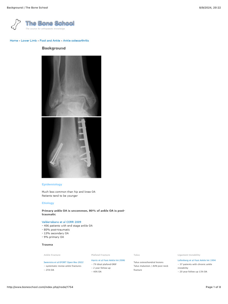 Ankle Osteoarthritis Overview and Management | PDF | Ankle ...