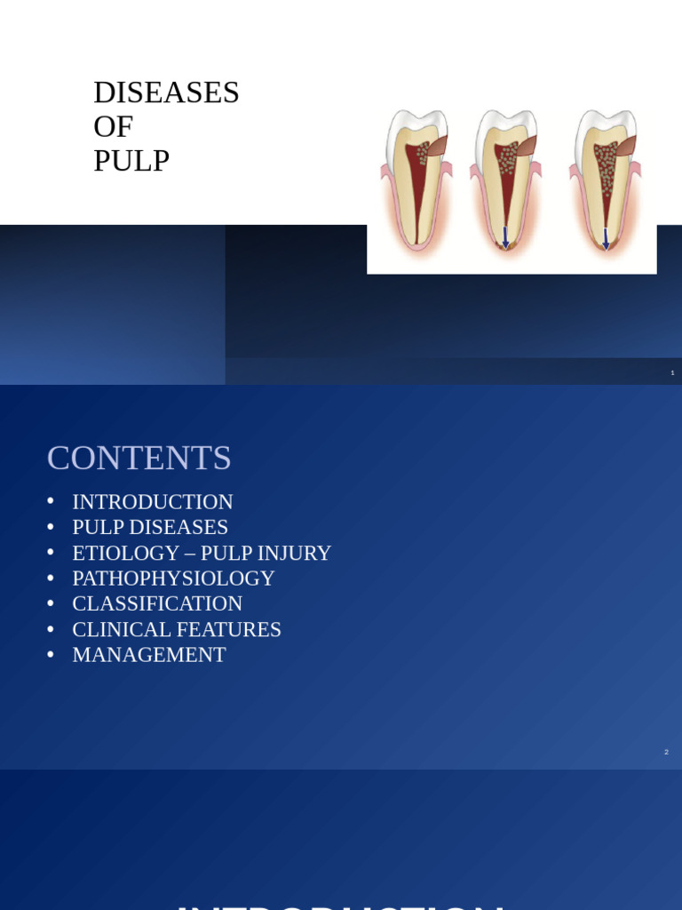 Pulp Al Diseases 1502 | PDF