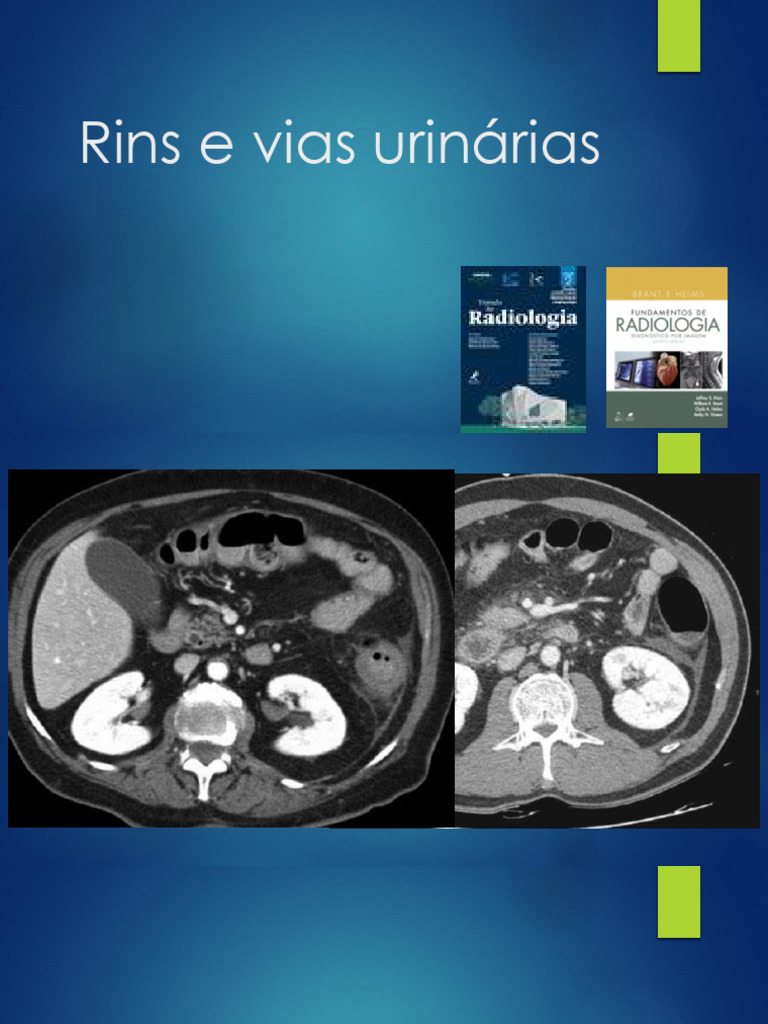 Aula de Rins e Vias Urin - Rias - M - Dulo 22 | PDF