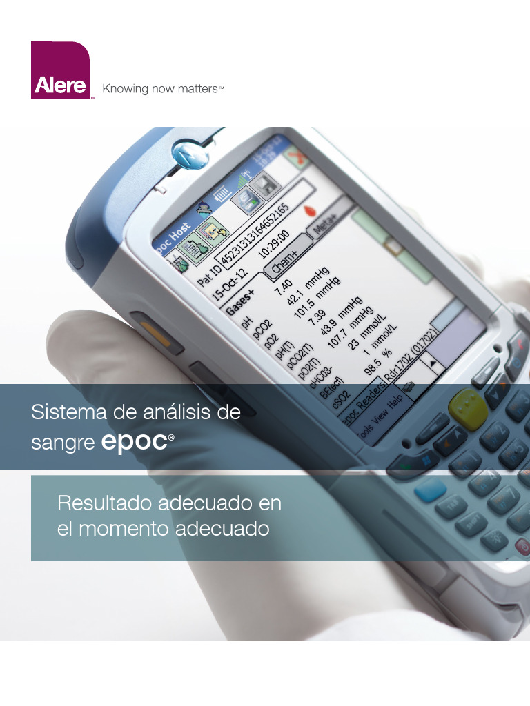 Epoc | PDF