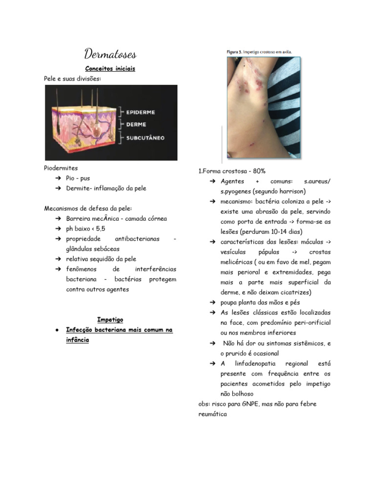 Dermatoses | PDF