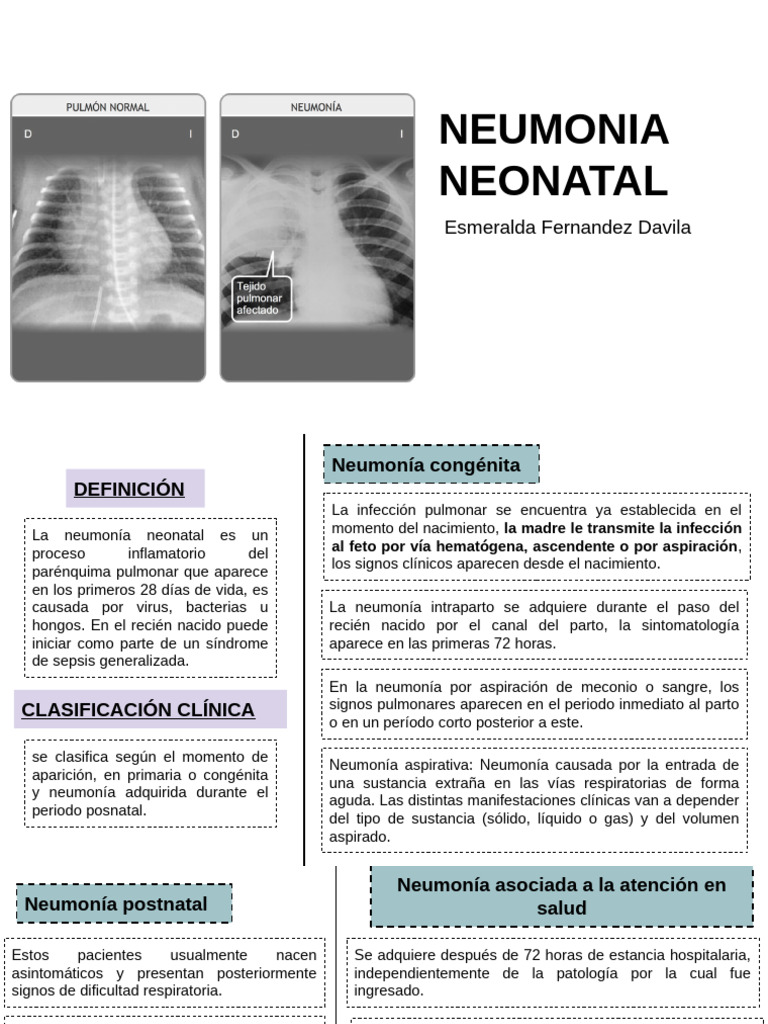 Neumonia Neonatal | PDF