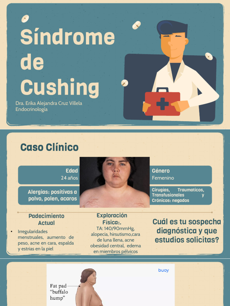 Cushing | PDF