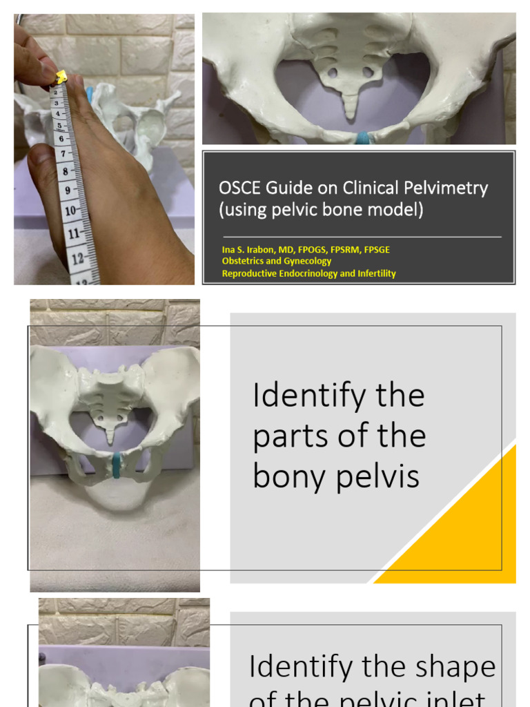 Clinical Pelvimetry Version 2 | PDF