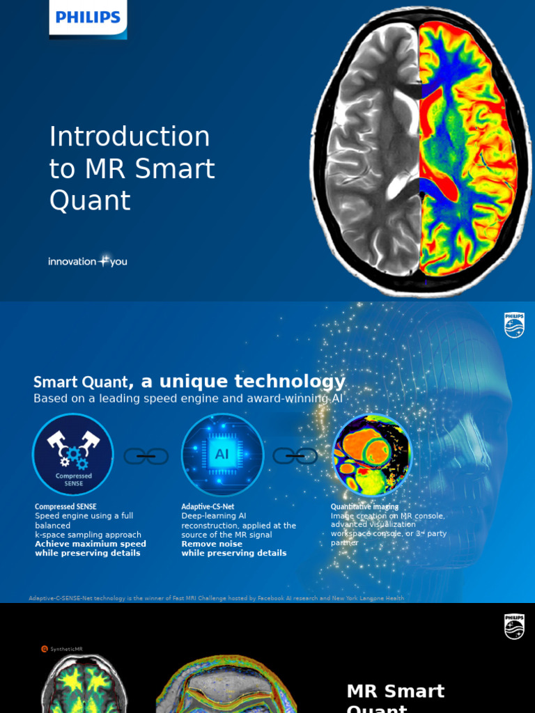MR Smart Quant | PDF