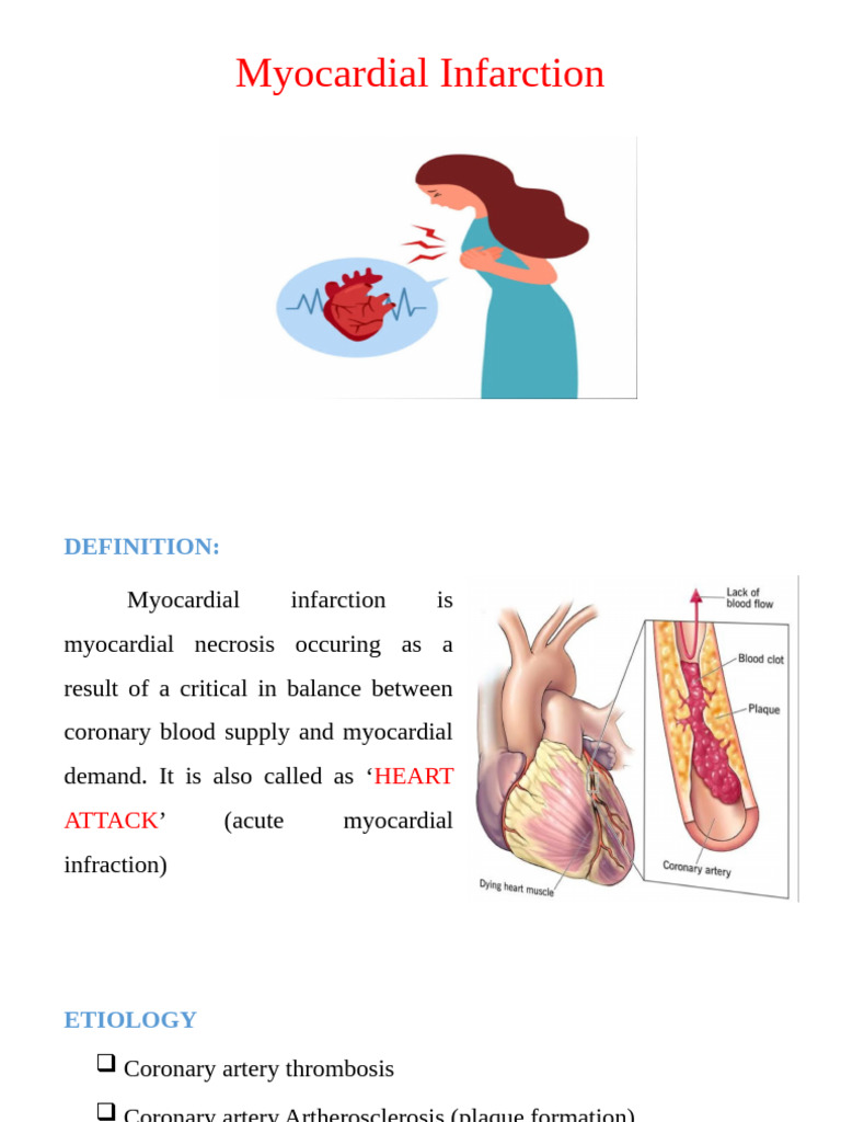 Myocardial Infarction | PDF