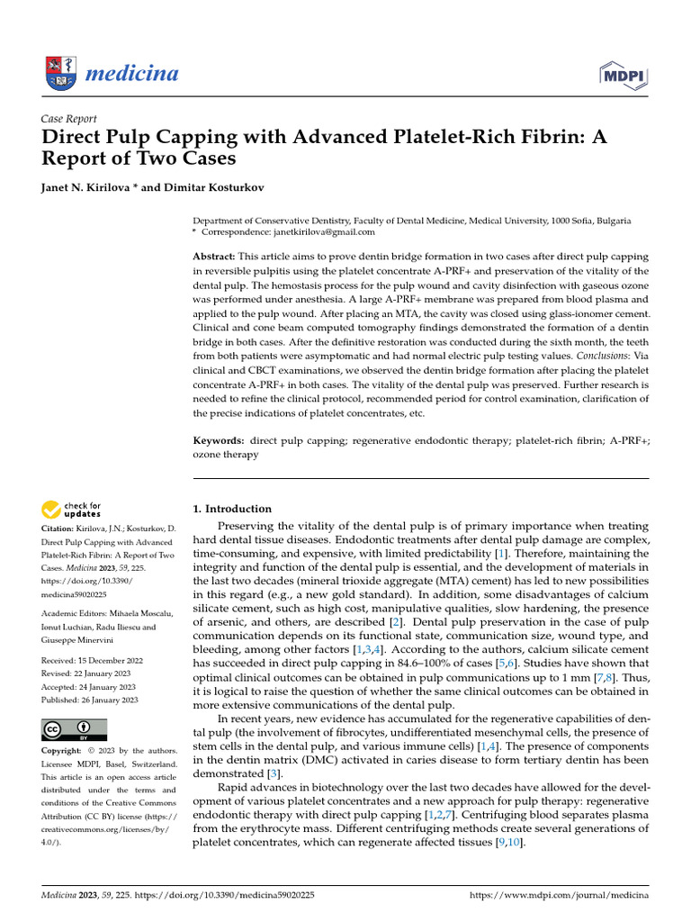 Direct Pulp Capping With Advanced Platelet-Rich Fibrin A Report of Two ...