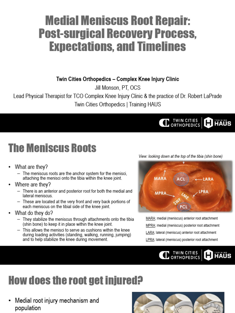 JMonson Post-Op Meniscus Root Repair 2022-10 | PDF