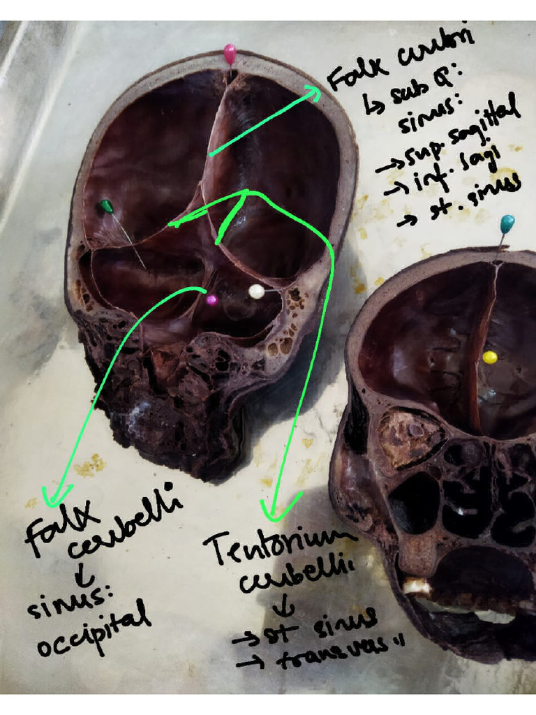 Gross Anatomy Specimens | PDF