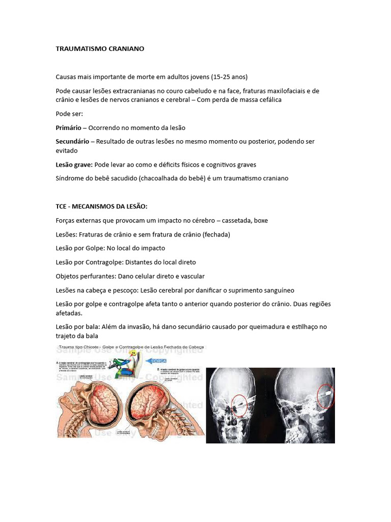 Traumatismo Craniano | PDF