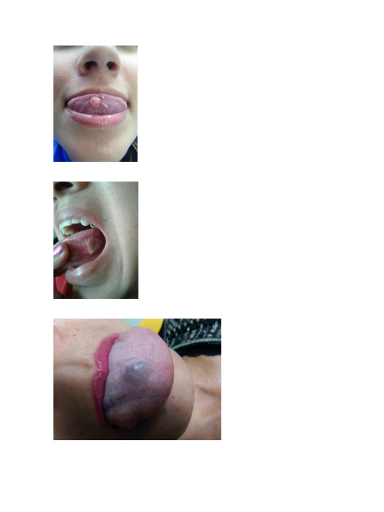 Lesiones Elementales | PDF