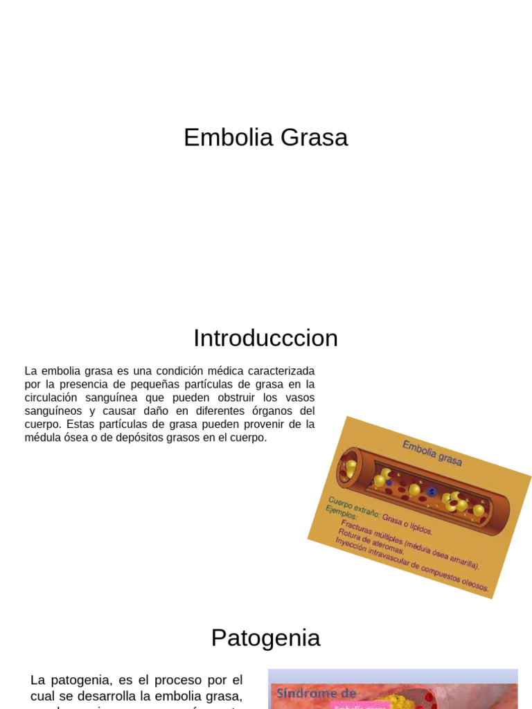 Embolia Grasa | PDF